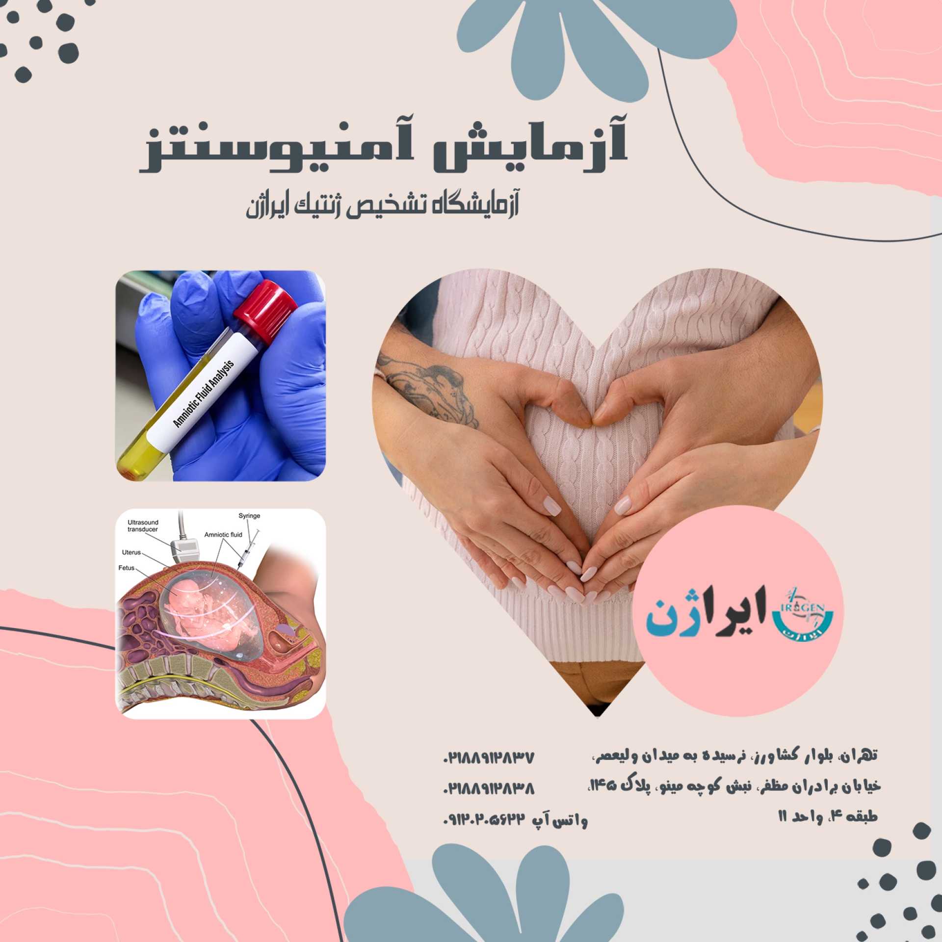 آزمایش آمنیوسنتز - آزمایشگاه تشخیص ژنتیک ایراژن